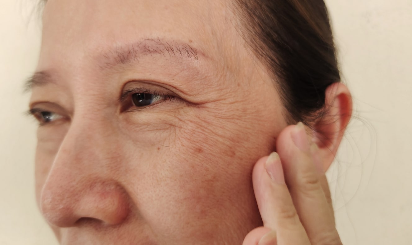 Best Treatments to Minimize Age Spots on Face & Hands