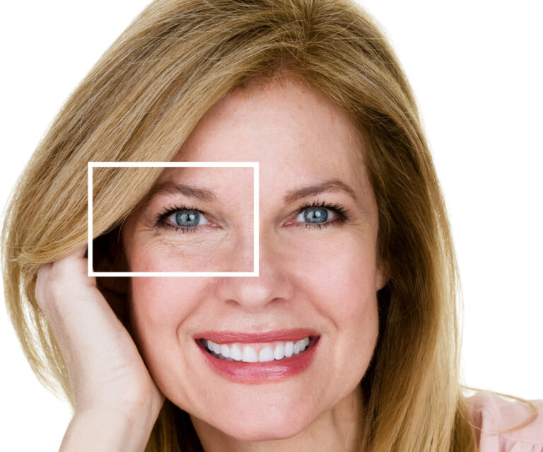8 Ways to Improve the Look of Your Aging Eye Area
