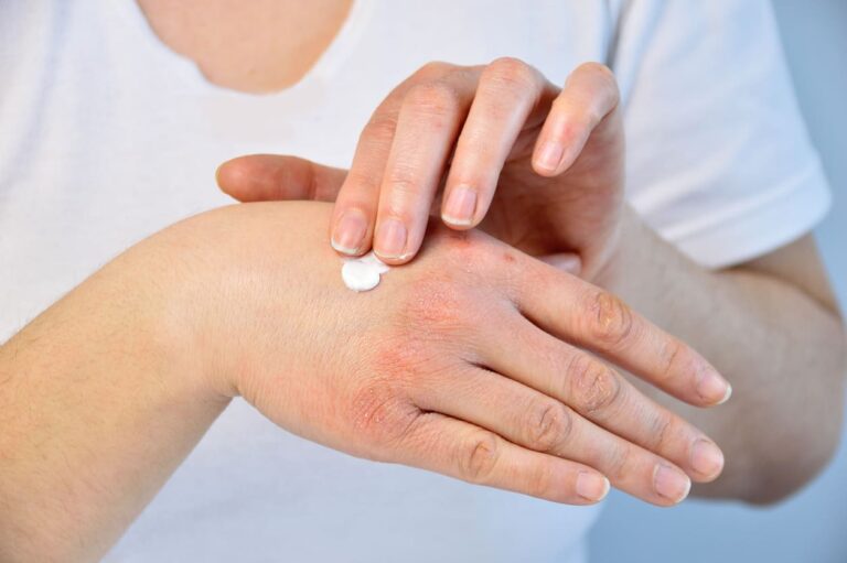 How to Stop Skin Inflammation - Prime Women | An Online Magazine