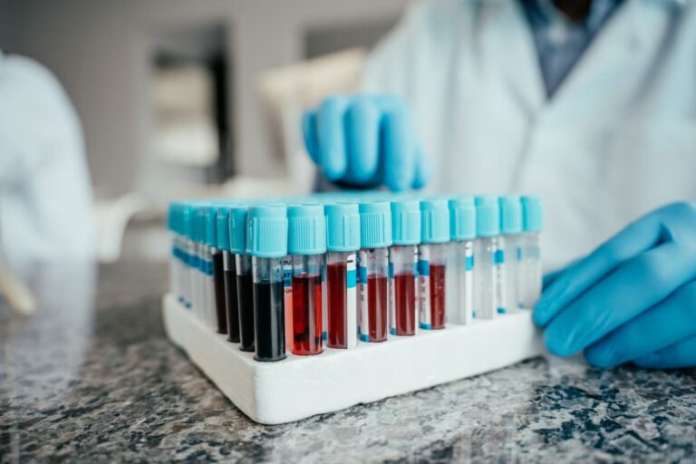 Why At-Home Blood Testing Is Worth Considering - Prime Women | An ...